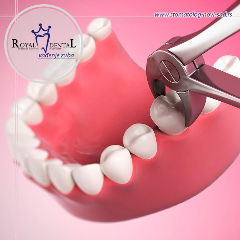 Vađenje zuba: polivalentni stomatolog ili oralni hirurg? - Stomatolog ...
