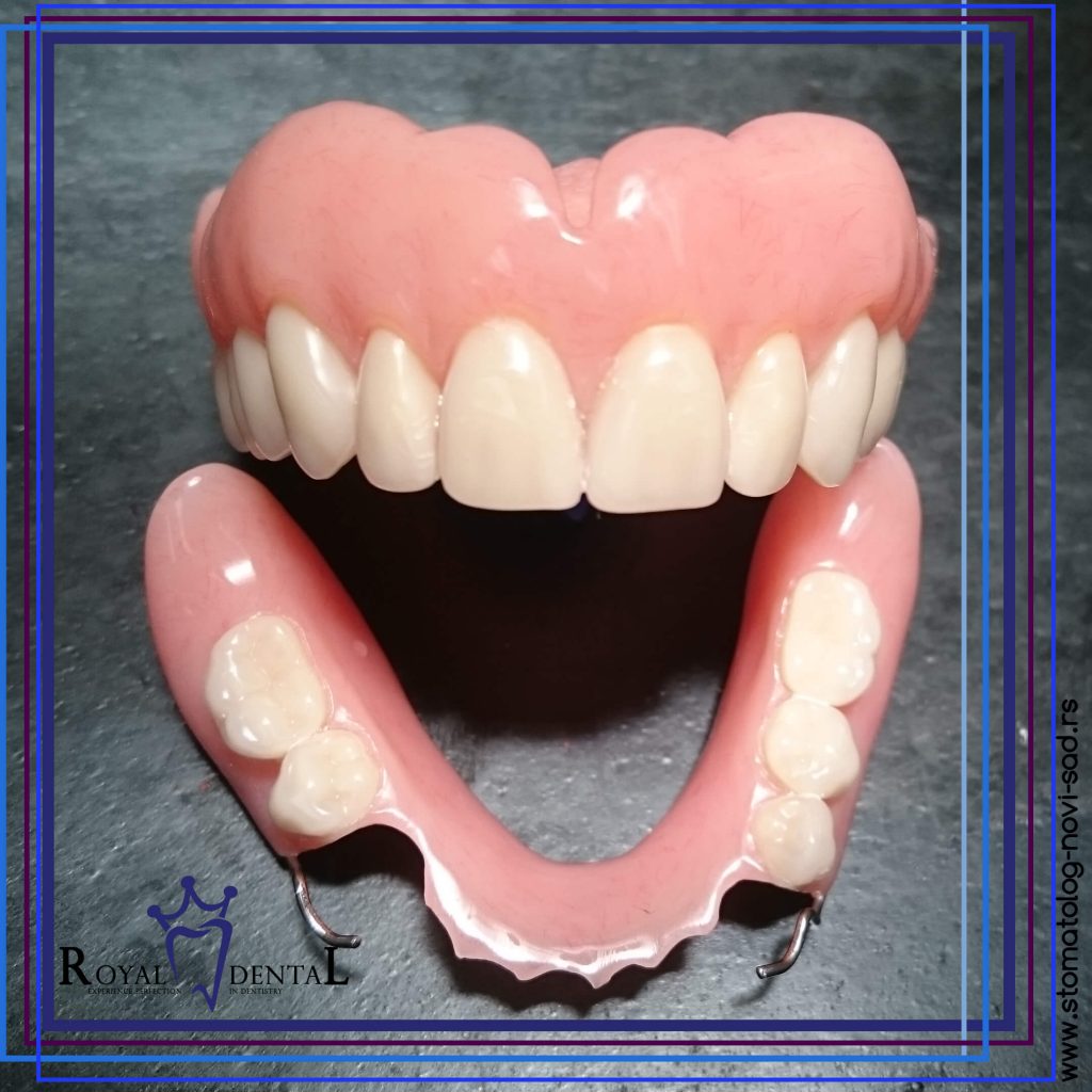Kako se što lakše naviknuti na mobilne proteze? - Stomatolog Novi Sad ...